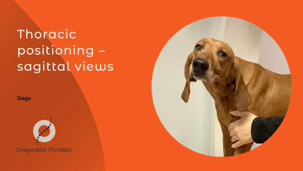 Thoracic positioning – sagittal views - Diagnostic Mindset